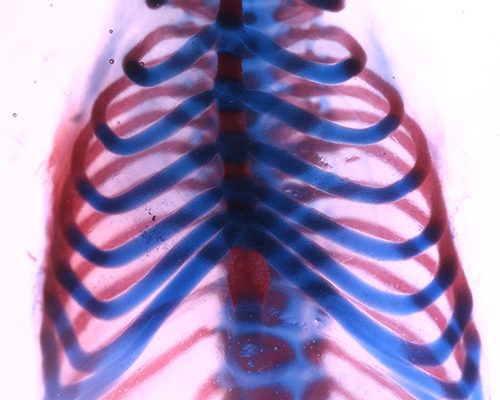 USC researchers discover the healing power of “rib tickling” by Hem...