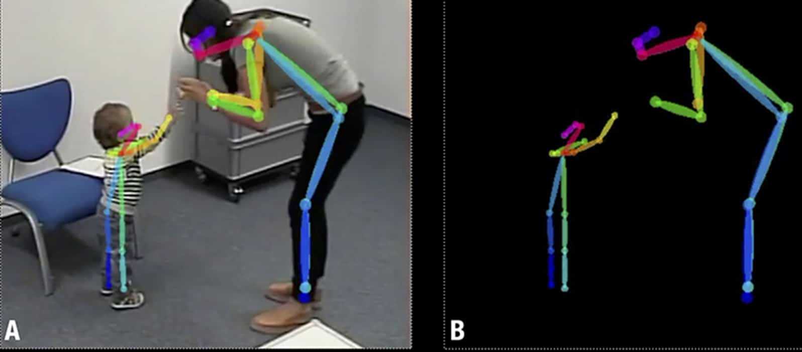 Using AI, scientists developed a device to detect autism by Total Q...